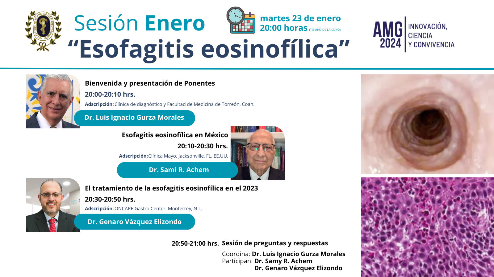 Sesión Mensual Enero 2024: Esofagitis eosinofílica | Asociación ...